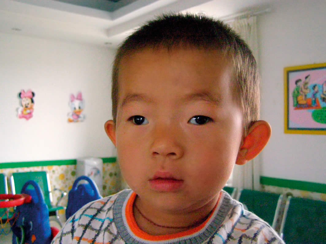 Community Eye Health Journal » Understanding, detecting and managing ...