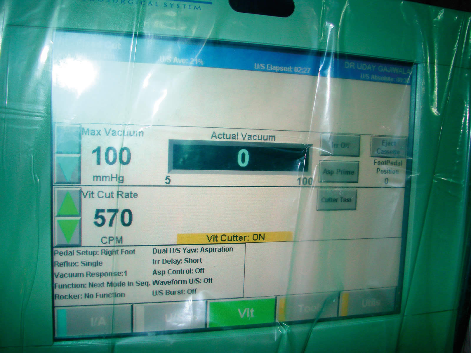 Community Eye Health Journal » Management of capsular rupture and ...