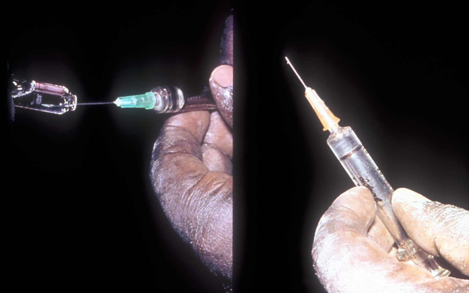 Community Eye Health Journal » Administering a subconjunctival injection