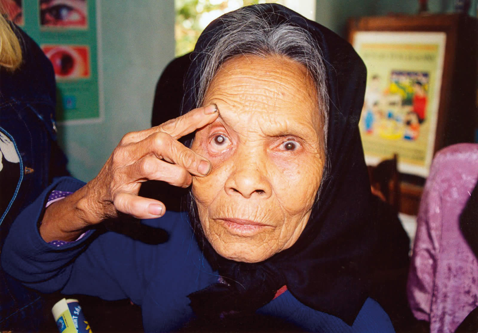 Community Eye Health Journal » Eye health in the future: what are the ...