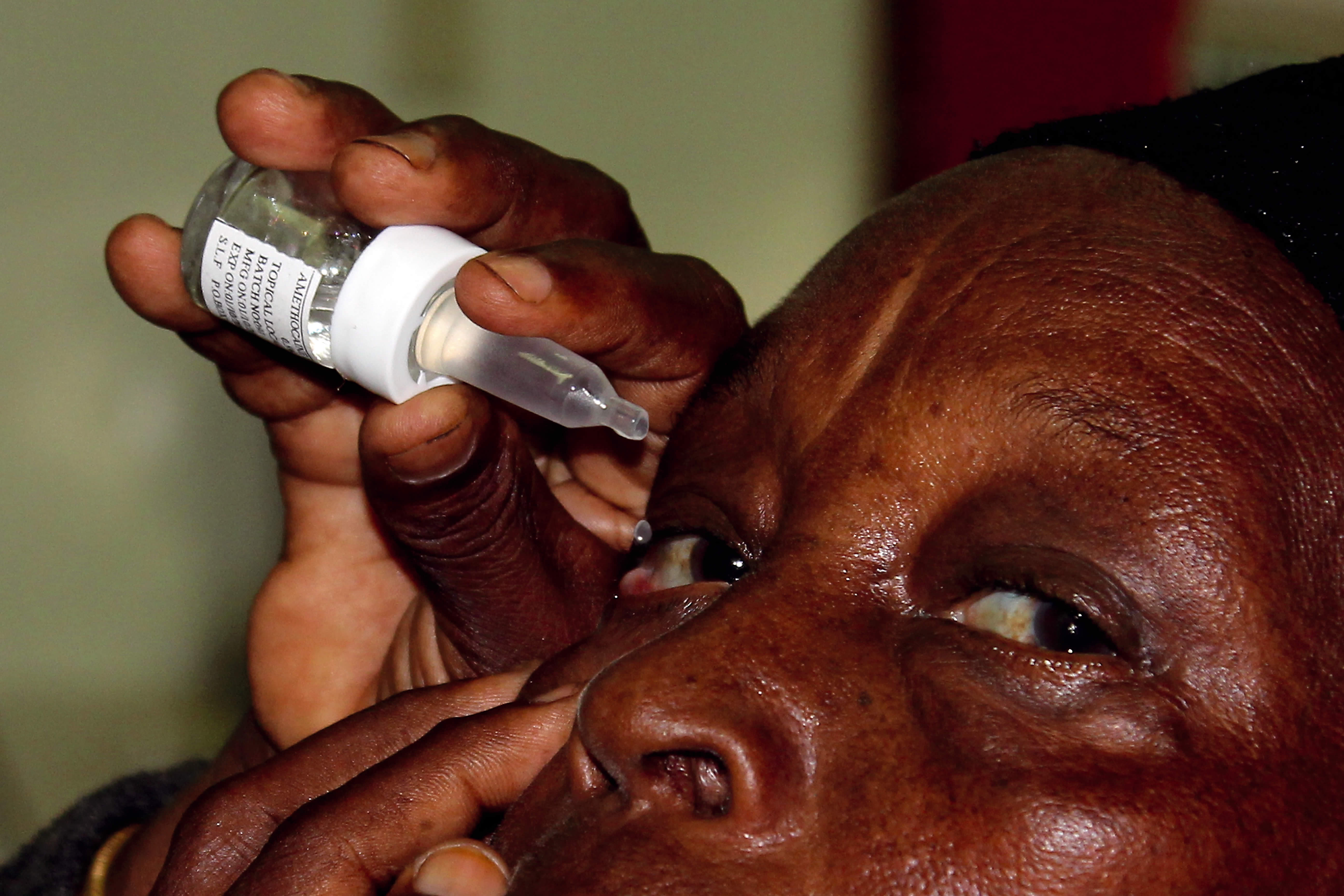 Community Eye Health Journal » Instilling your own eye drops
