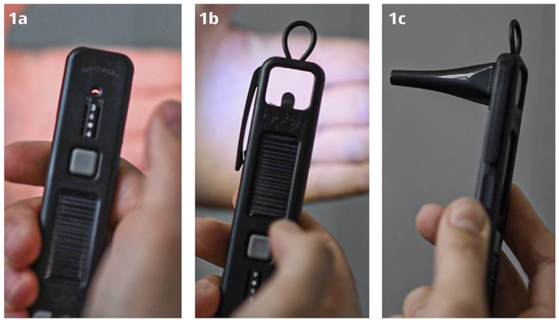 Community Eye Health Journal » The Arclight and how to use it