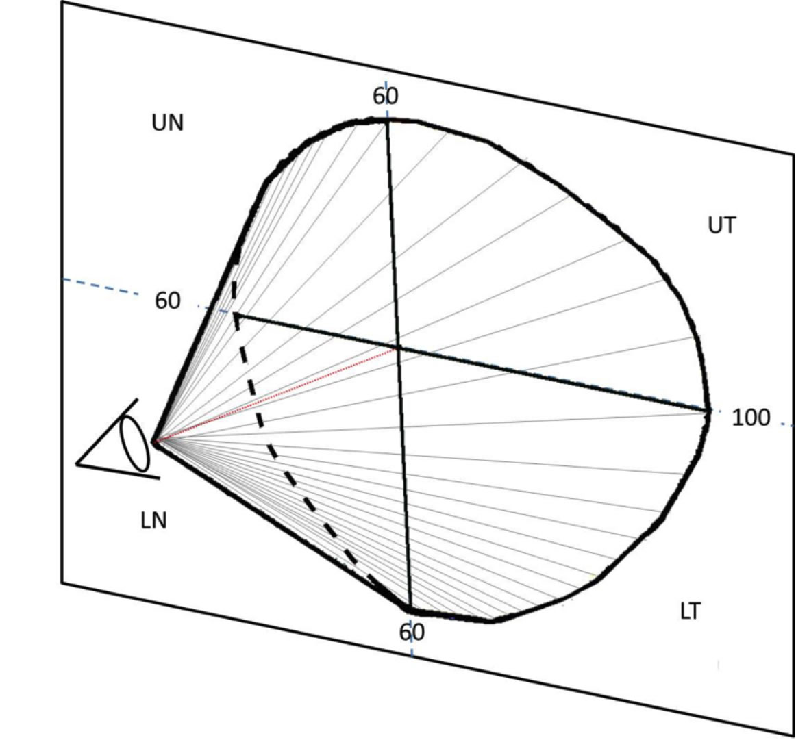 Community Eye Health Journal » Visual fields interpretation in glaucoma ...
