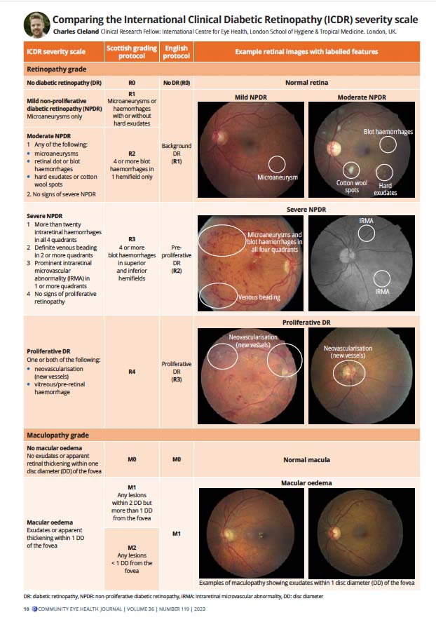 Community Eye Health Journal » Comparing the International Clinical ...