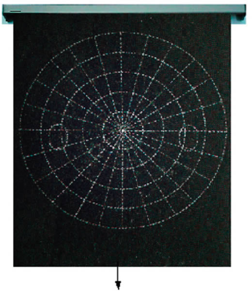 Community Eye Health Journal » Visual field testing for glaucoma – a ...