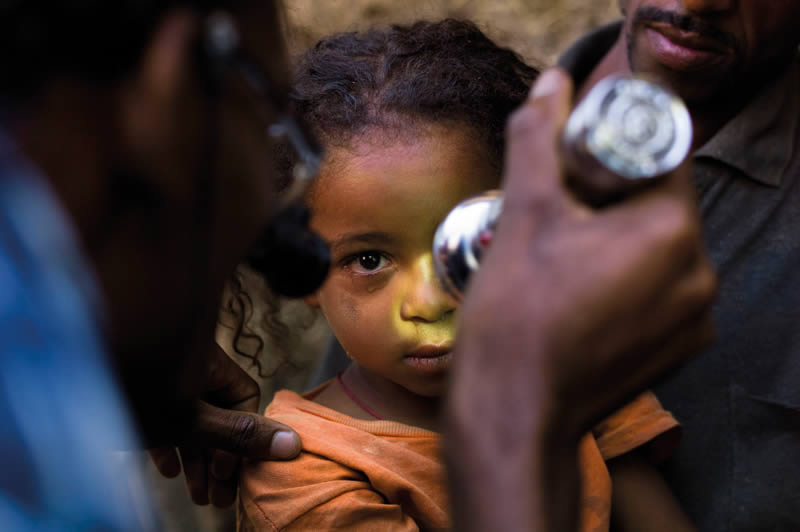 Community Eye Health Journal » Neglected communities