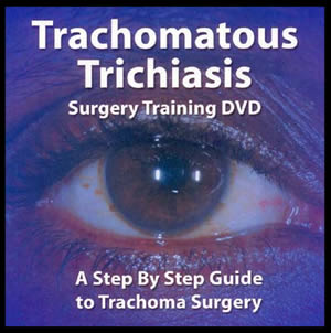 Community Eye Health Journal » Trachomatous trichiasis surgery training DVD